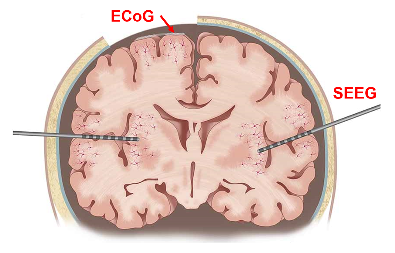Protocol介绍 | 人体颅内解剖学和电生理数据的综合分析 – User's Blog!